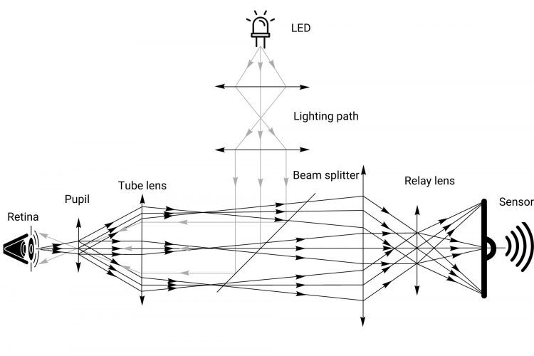 Optical Coherence Tomography (OCT) - Avantier Inc.