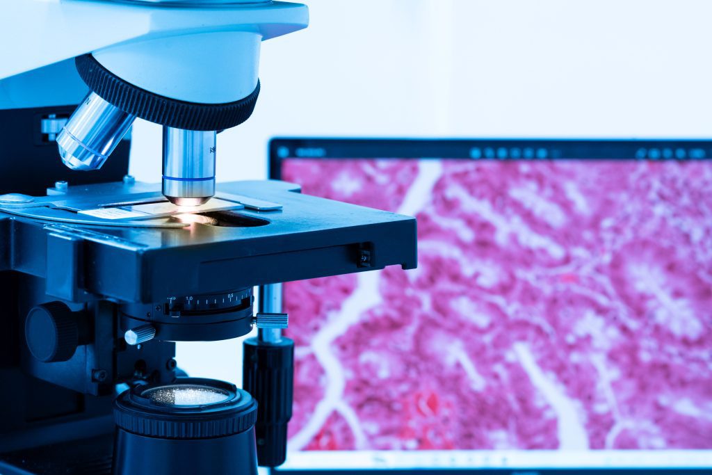 Revolutionizing Live Cell Imaging with Oblique Illumination & AI
