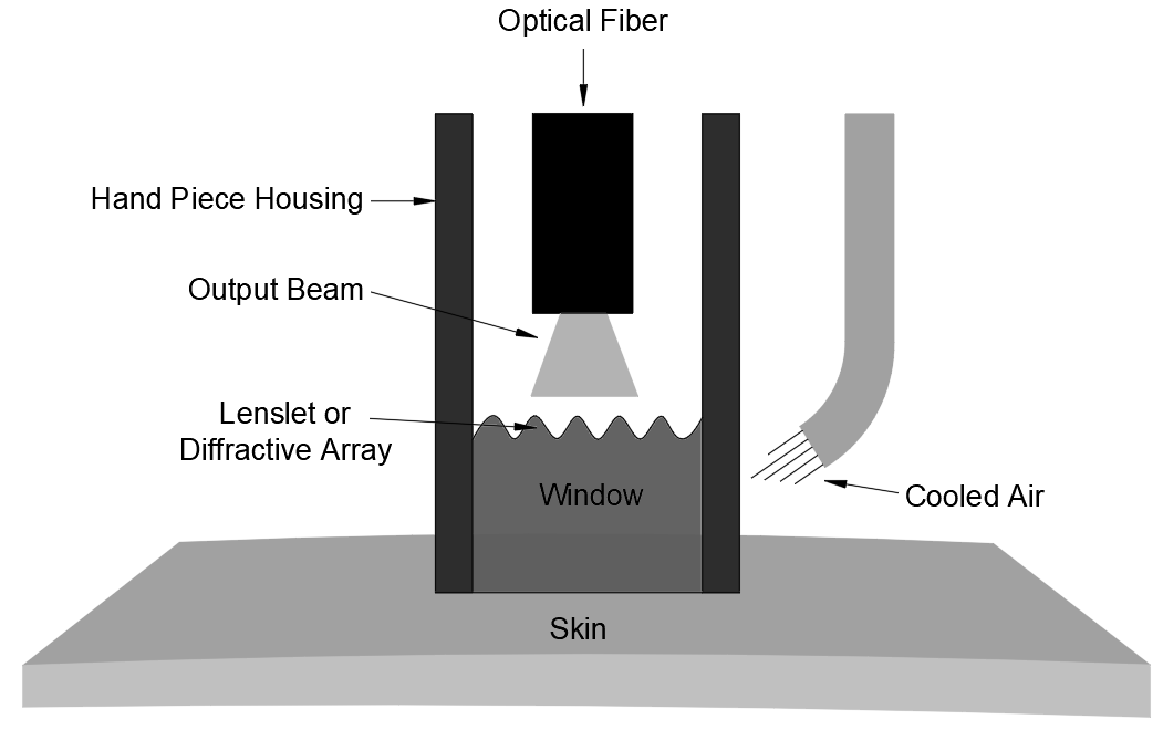 Laser Optics: Skin Rejuvenation and Tattoo Removal