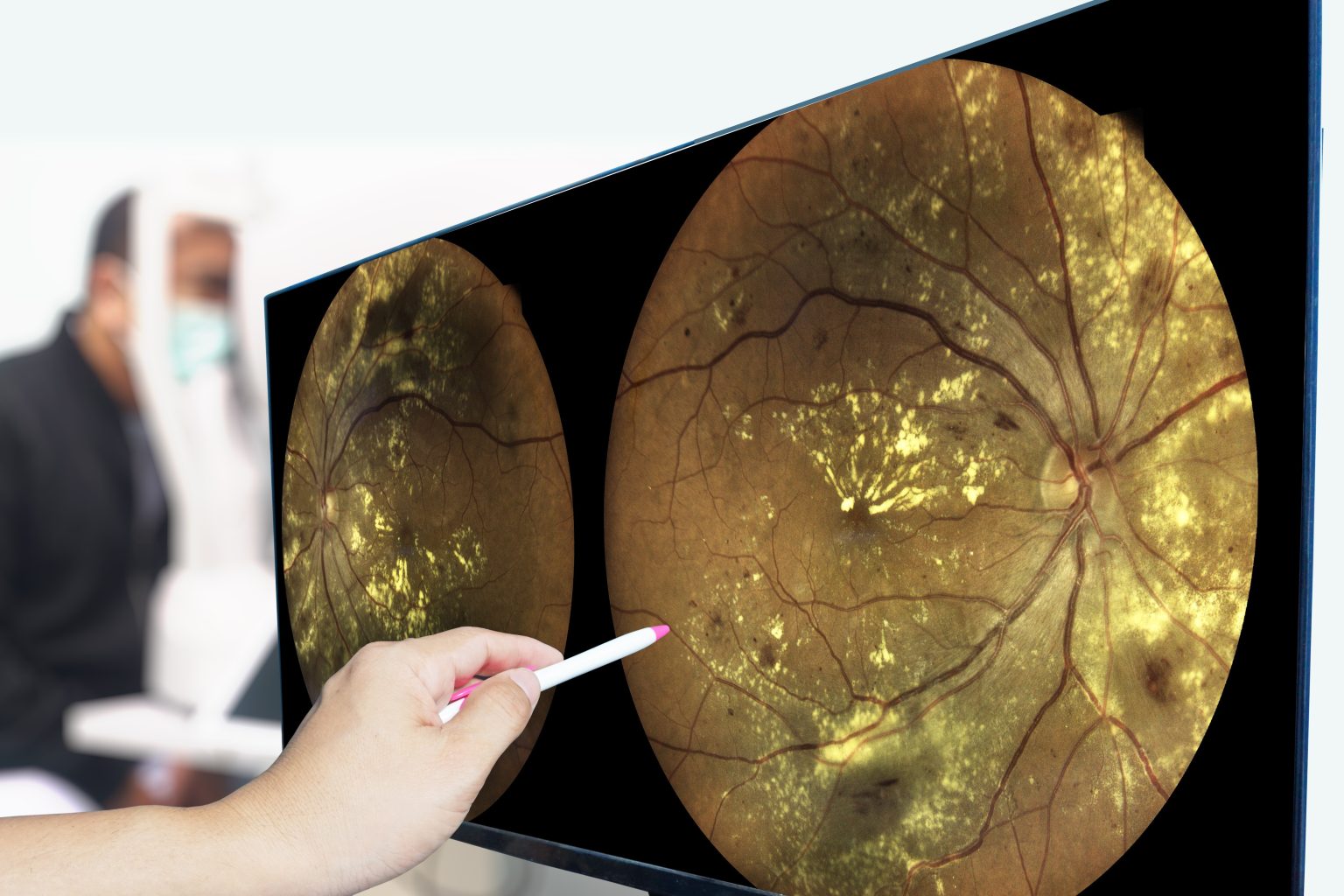 Introduction to Adaptive Optics - Avantier Inc.