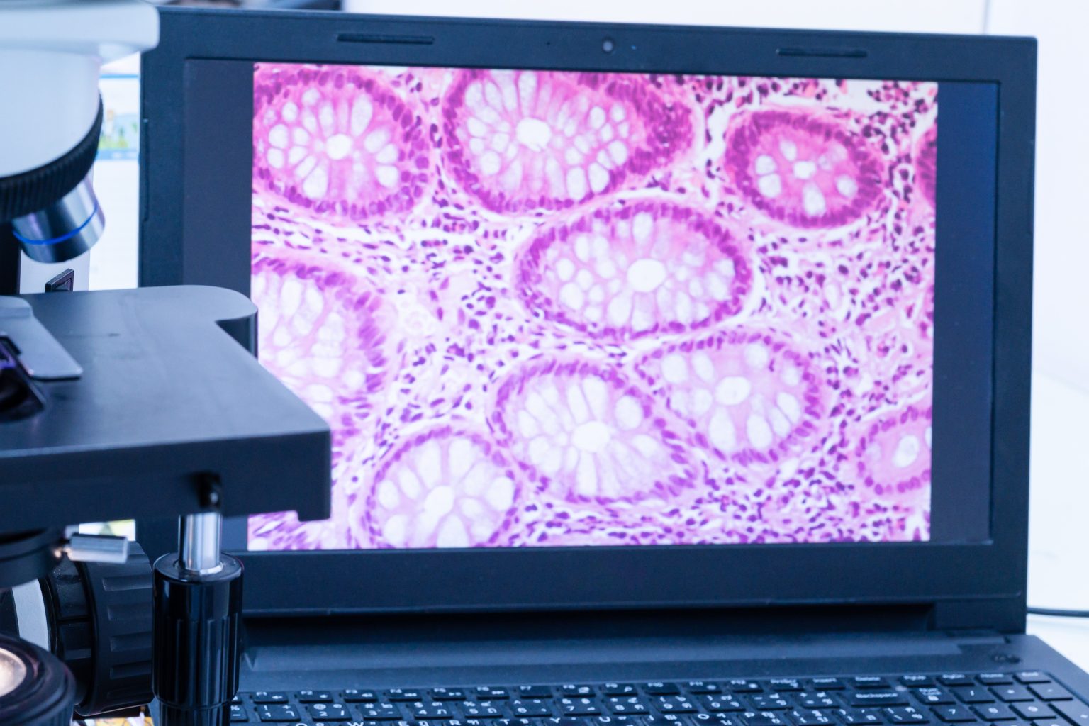 Super-resolution Fourier Ptychographic Microscopy - Avantier Inc.