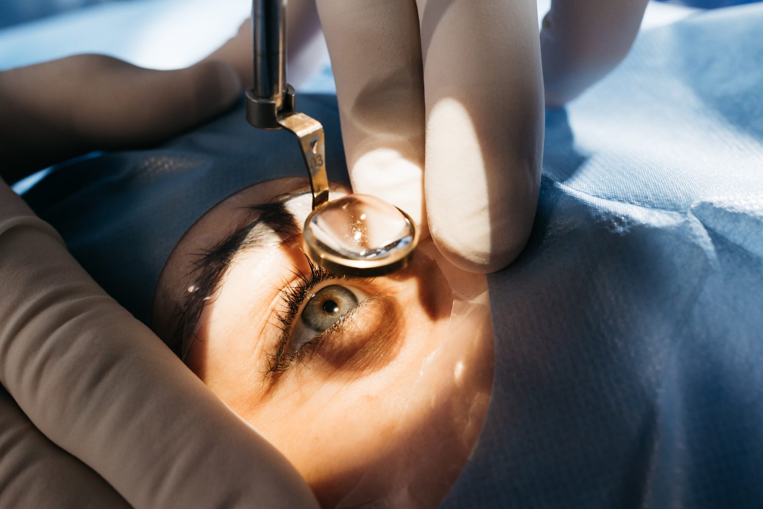 Laser Optics for Surgery - Avantier Inc.
