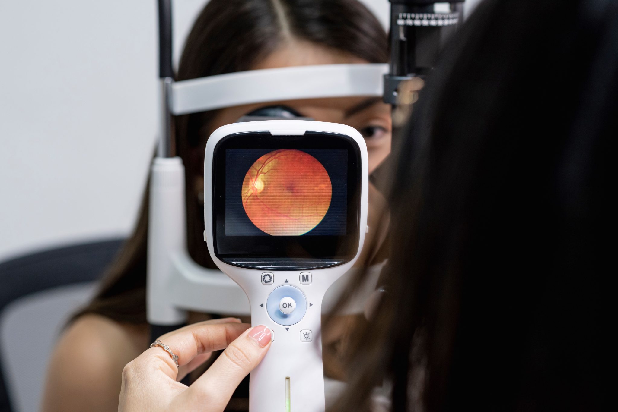 Case Study: Eye Lesion Detection Medical Lens - Avantier Inc.