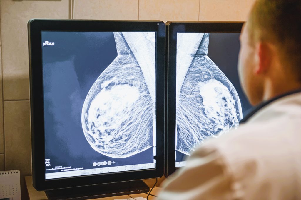 How Does Diffuse Optical Tomography Work? - Avantier Inc.